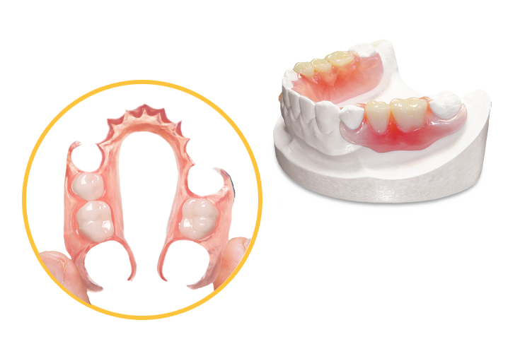 Bayshore Dental Studio | Removables